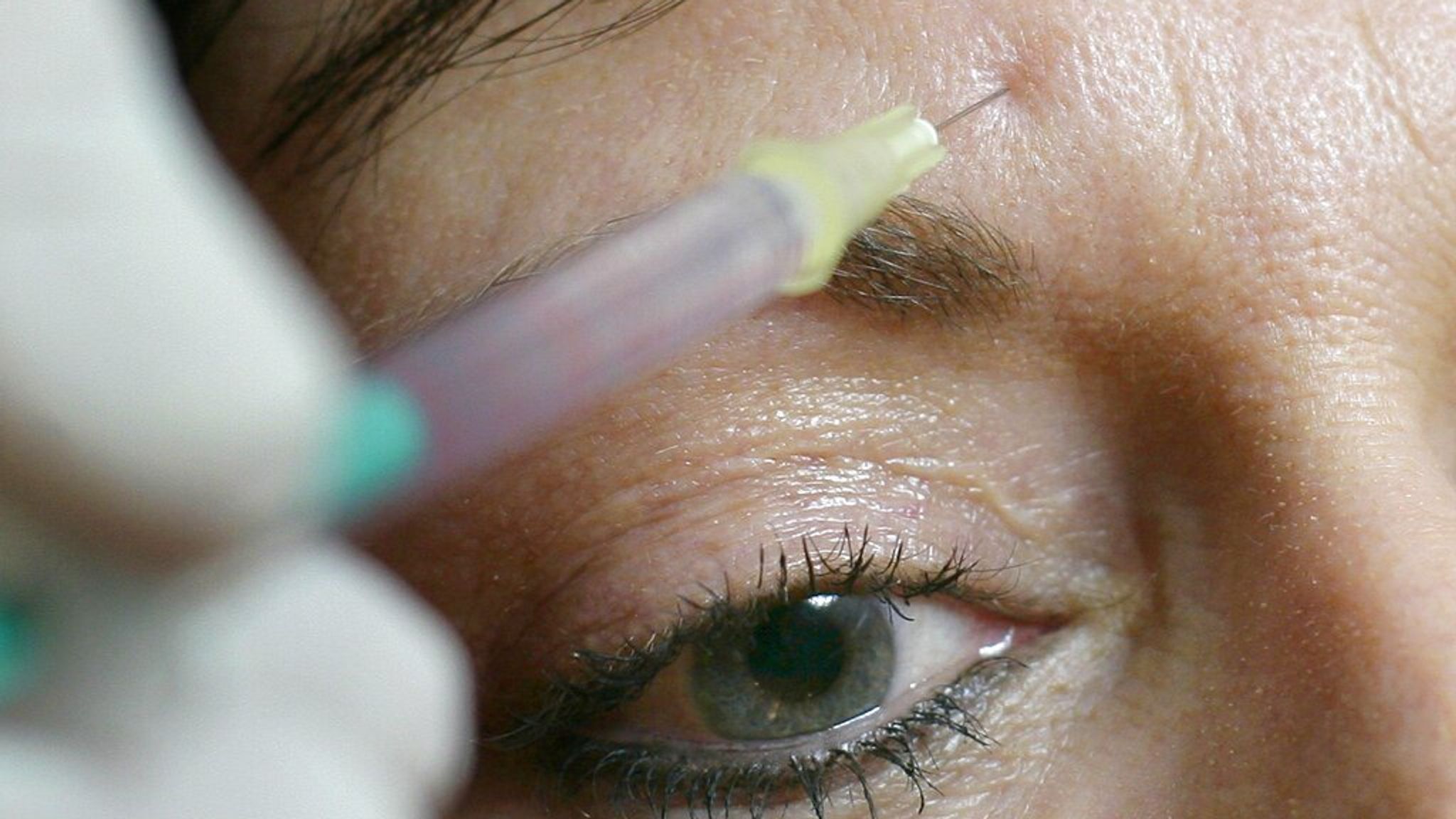 Modified Botox: New Pain Relief for Chronic Nerve Pain?